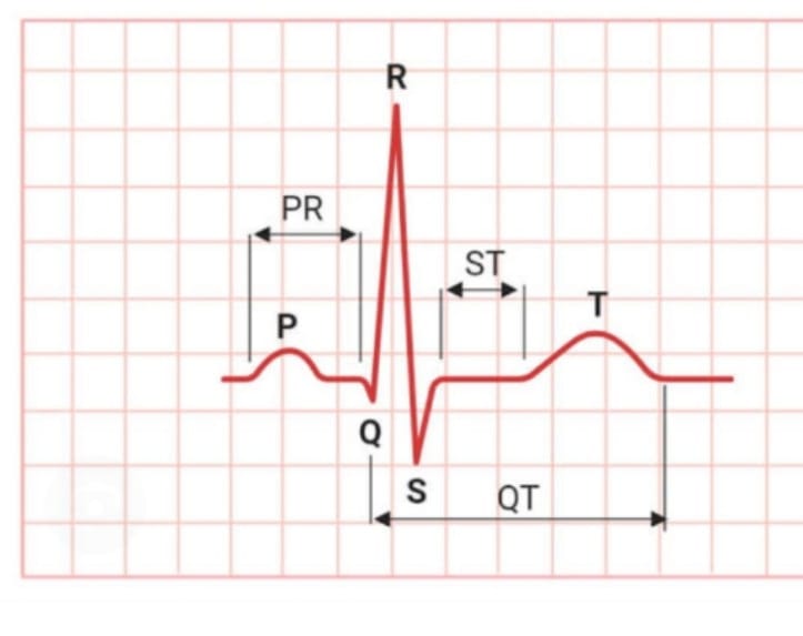 Transforming Heart Health: How RD Diagnostic Center's ECG Service is ...